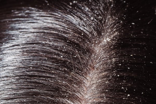 70+ Wonderful Uses of White Vinegar