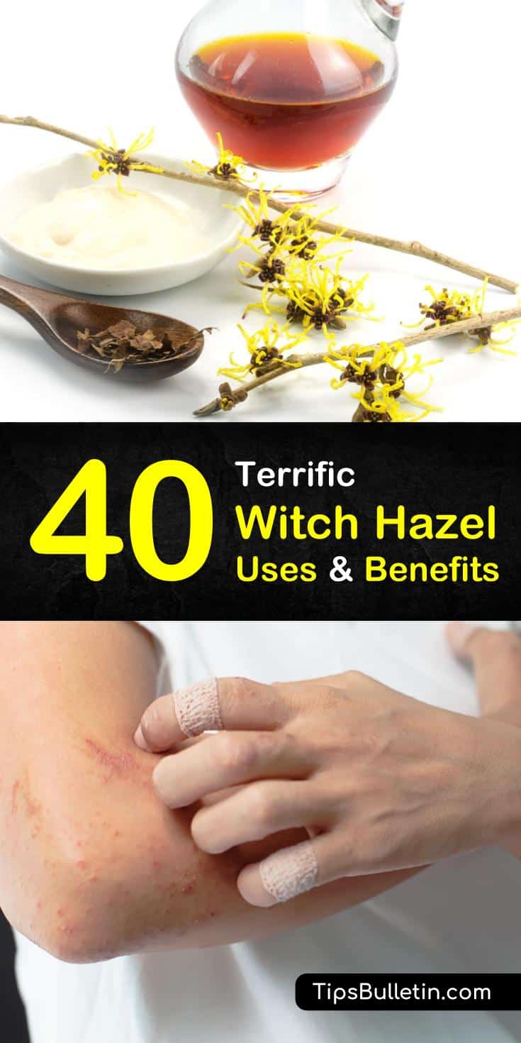 40 Amazing Witch Hazel Uses and Benefits