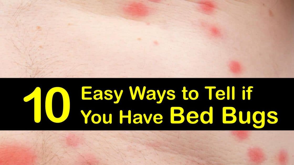 10 Easy Ways to Tell if You have Bed Bugs